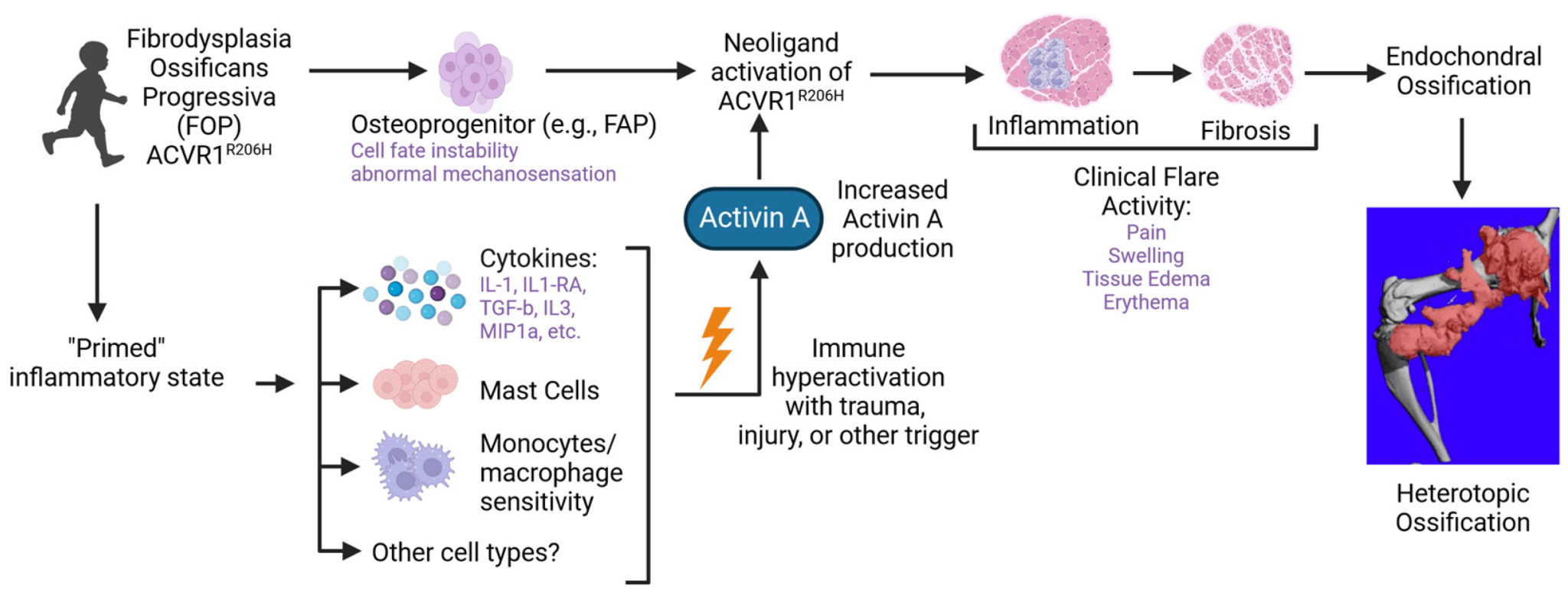 Fibrodysplasia Ossificans Progressiva (FOP) – 1/1,000,000 People ...