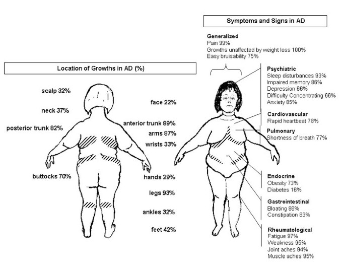 Dercum’s Disease – Prevalence Unknown – Rare Disease Insights